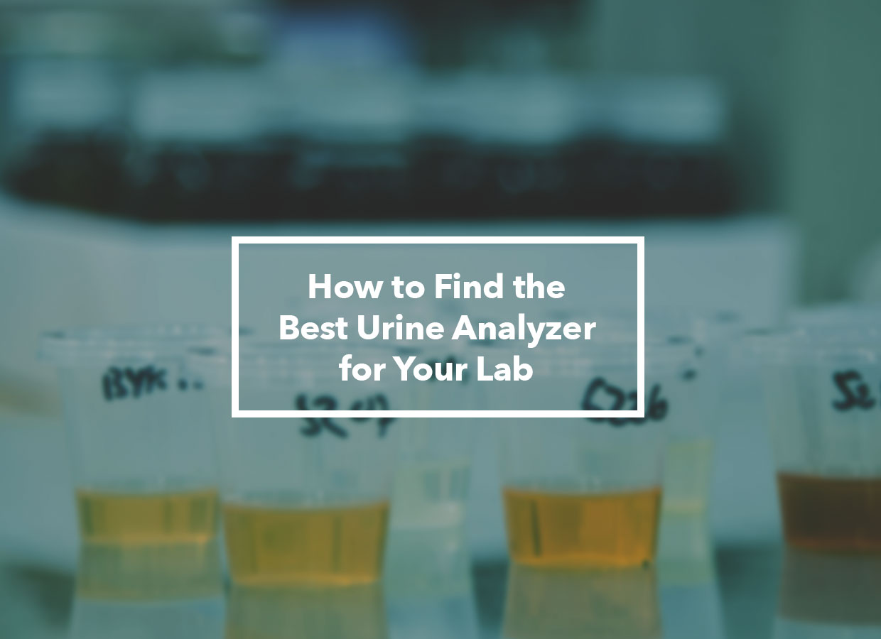 How to Find the Best Urine Analyzer for Your Lab